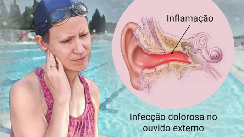 Otite.Dicas para um ouvido saudável! - INmedi